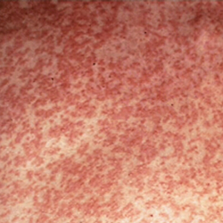 PLP - Primary Learning Program