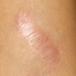 PLP - Primary Learning Program